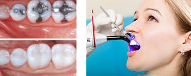 Cosmetics - Hitomi Dental Office